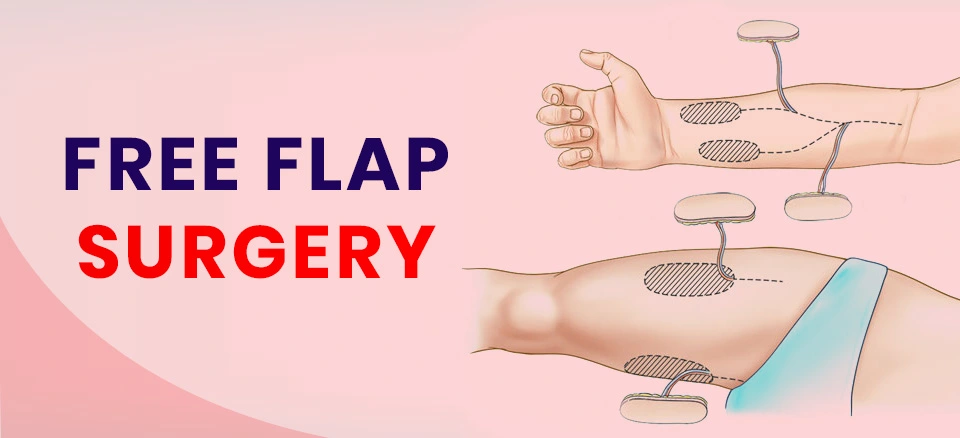 Free Flap surgery in Kanpur | Skin Grafting in Kanpur